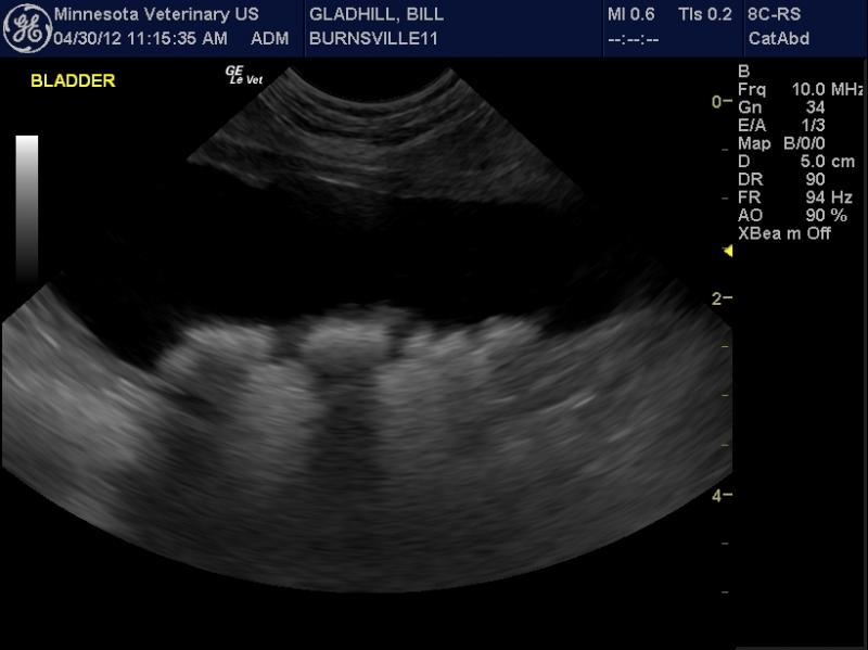 Urolithiasis +/- TCC - Members