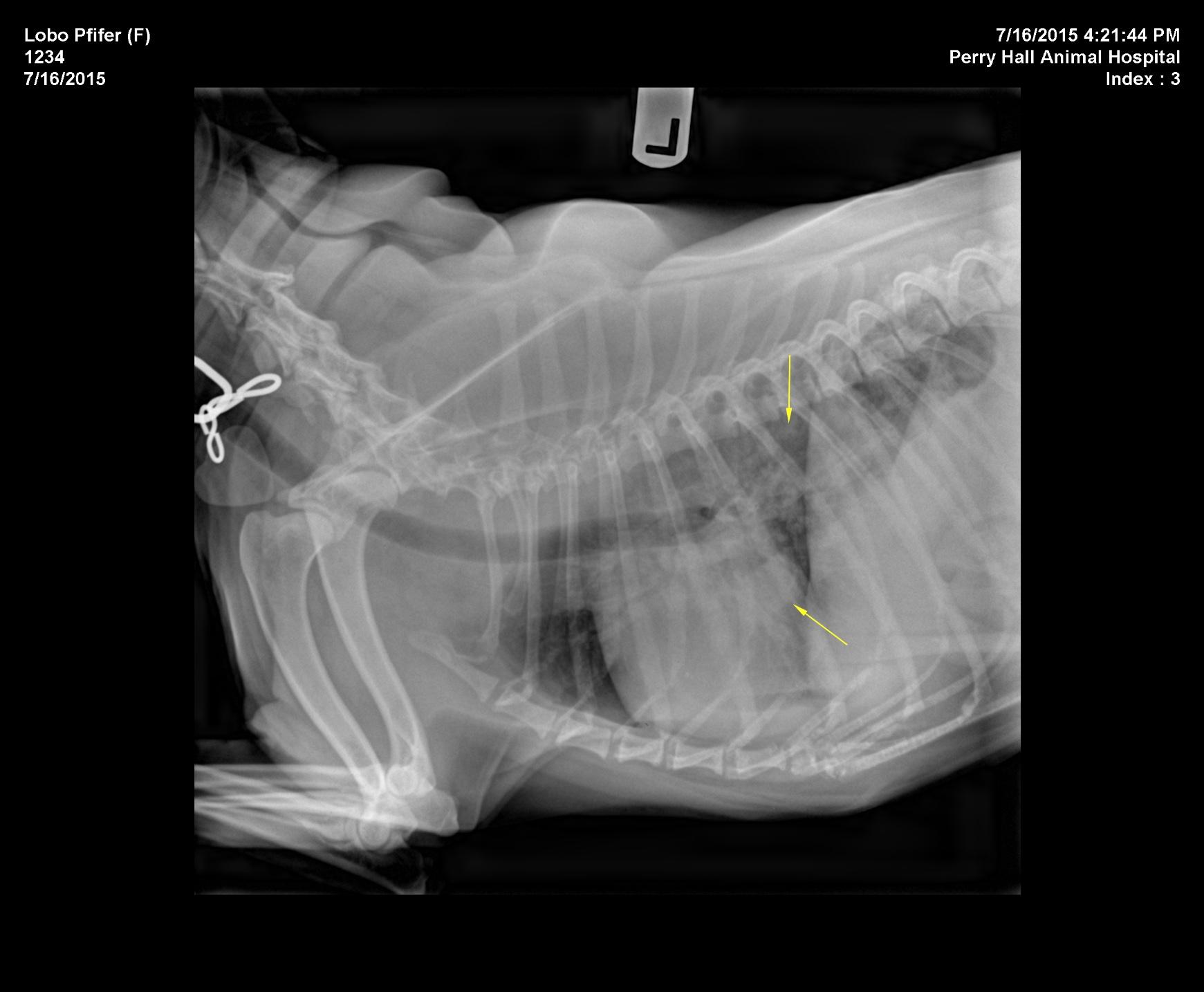 RADS: Left Atrial Enlargement and Pulmonary Venous Congestion in a 12 ...