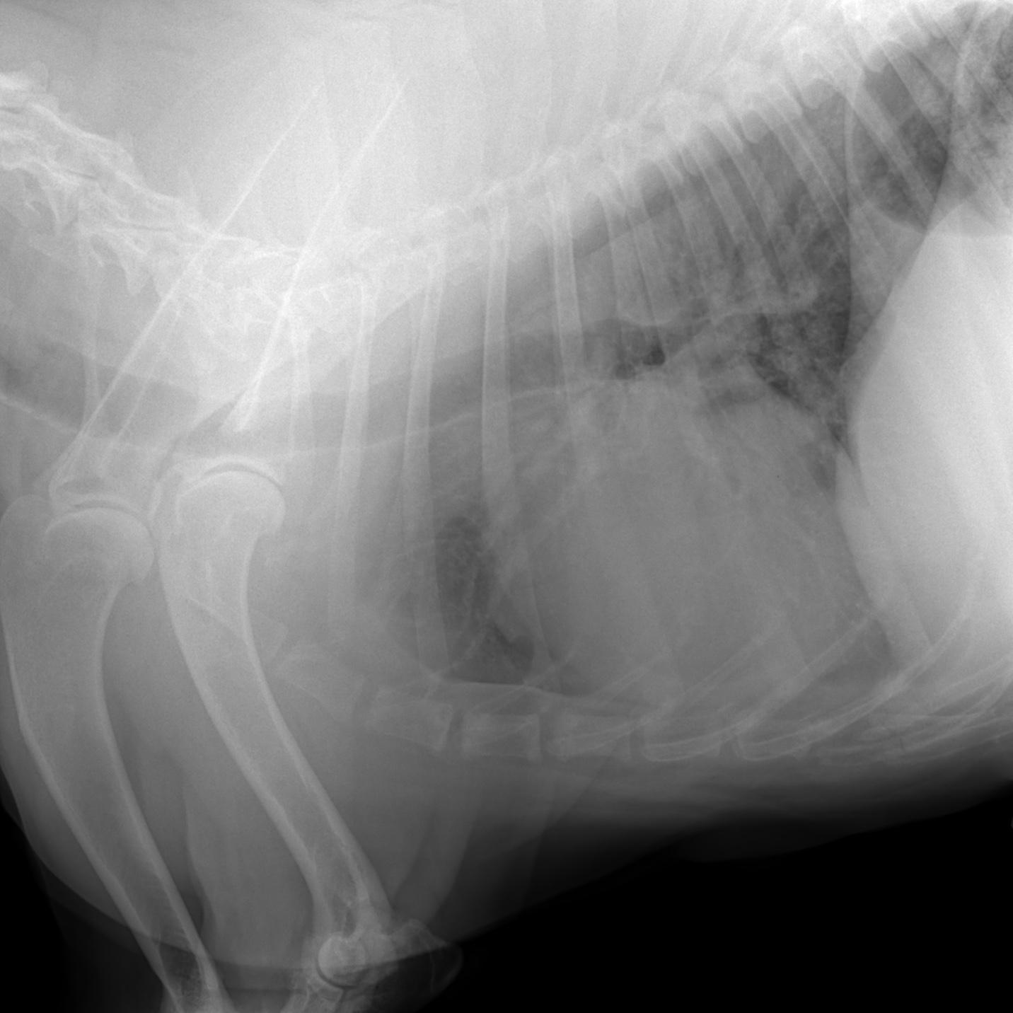 RADS - Chronic Upper Airway Obstruction with Chronic Inflammatory ...