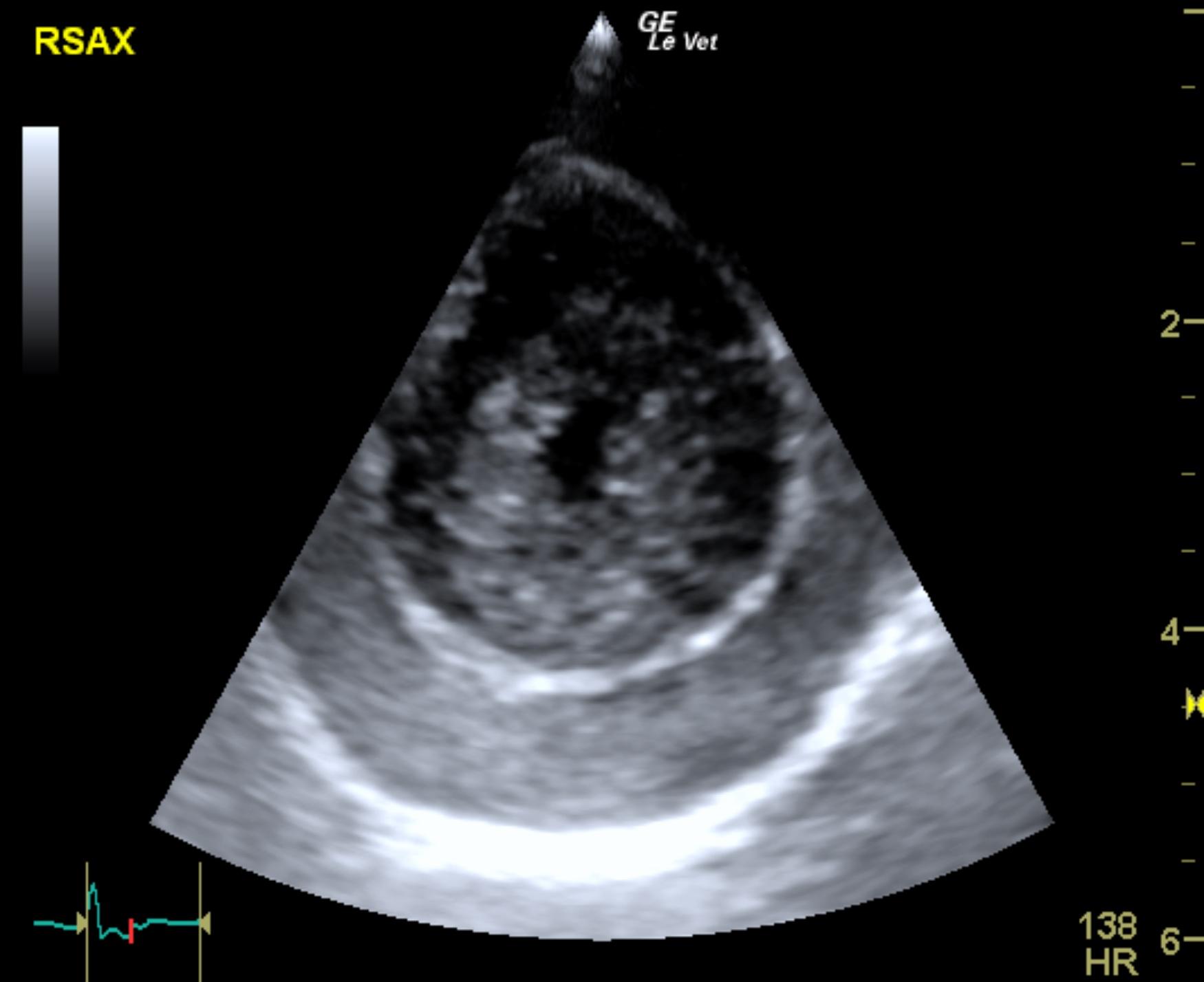 Degenerative Mitral Valve Disease, Pericardial Effusion and Left Atrial ...