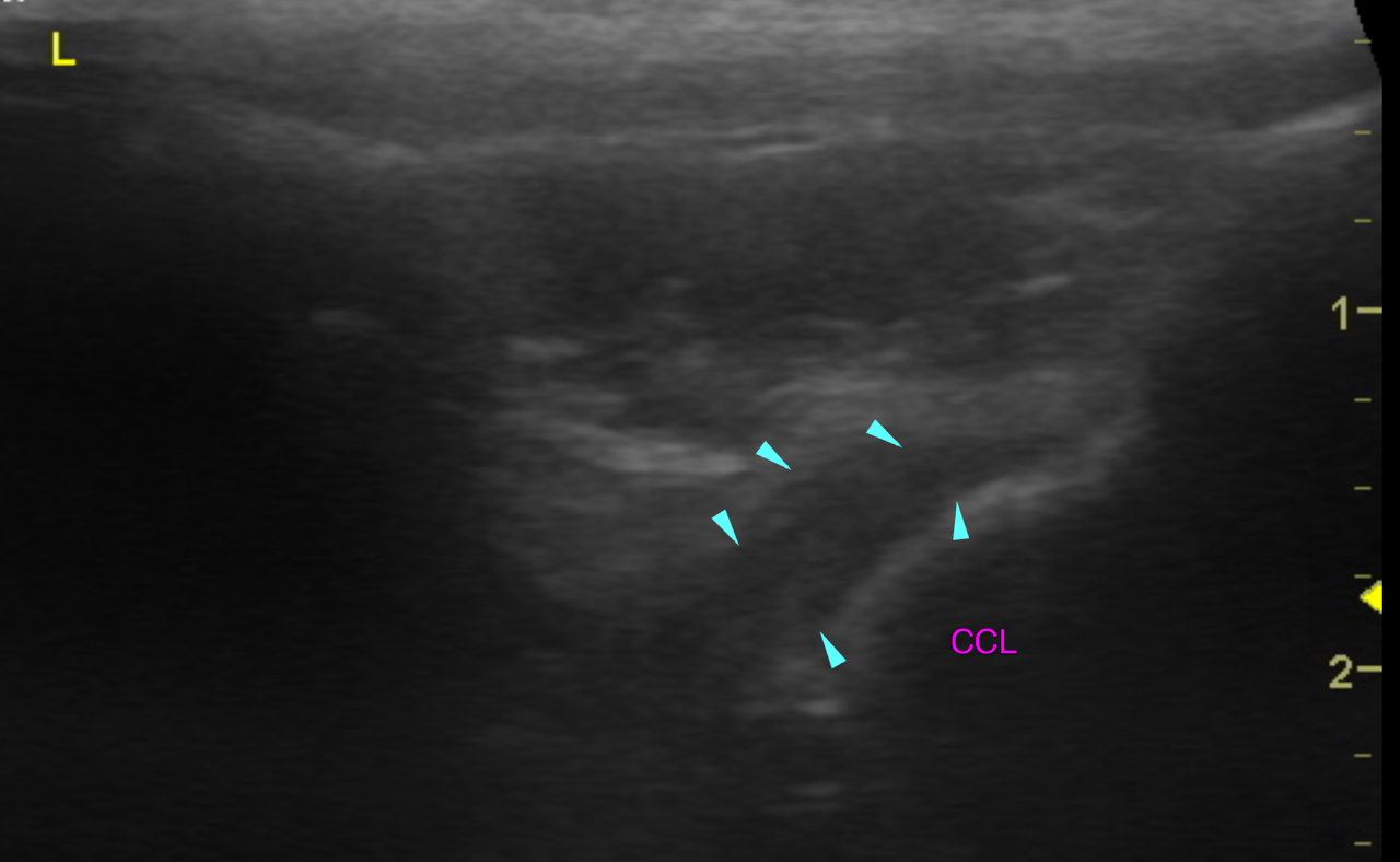 ORTHO - Full right cranial cruciate ligament (CCL) rupture in a 7 year ...
