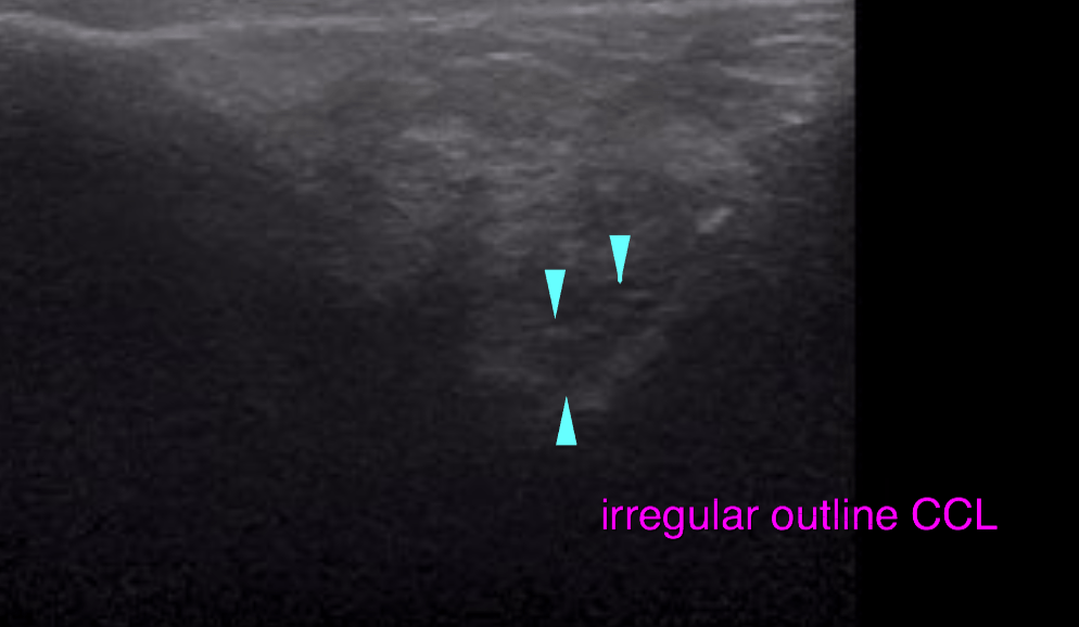 ORTHO - Partial rupture and elongation of the cranial cruciate ligament ...