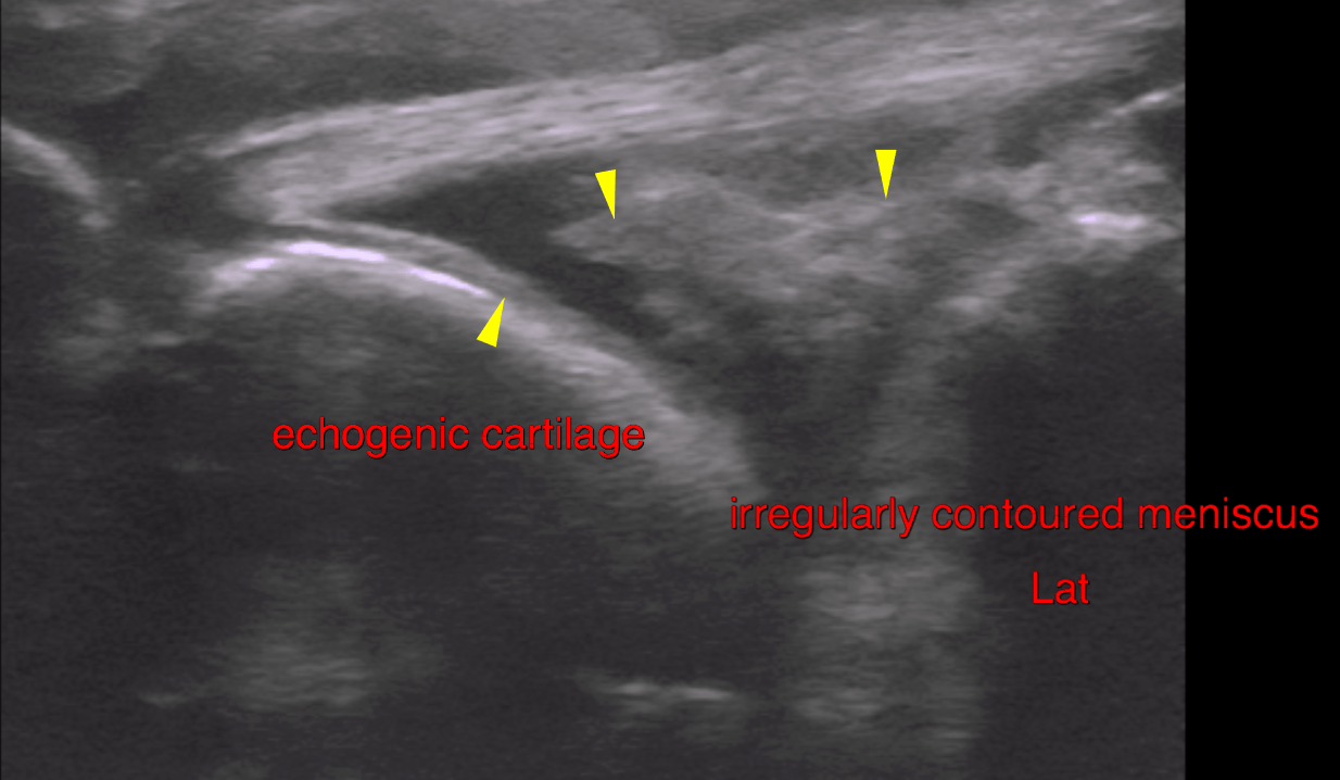 ORTHO - Cranial cruciate ligament (CCL) rupture with meniscal damage in ...