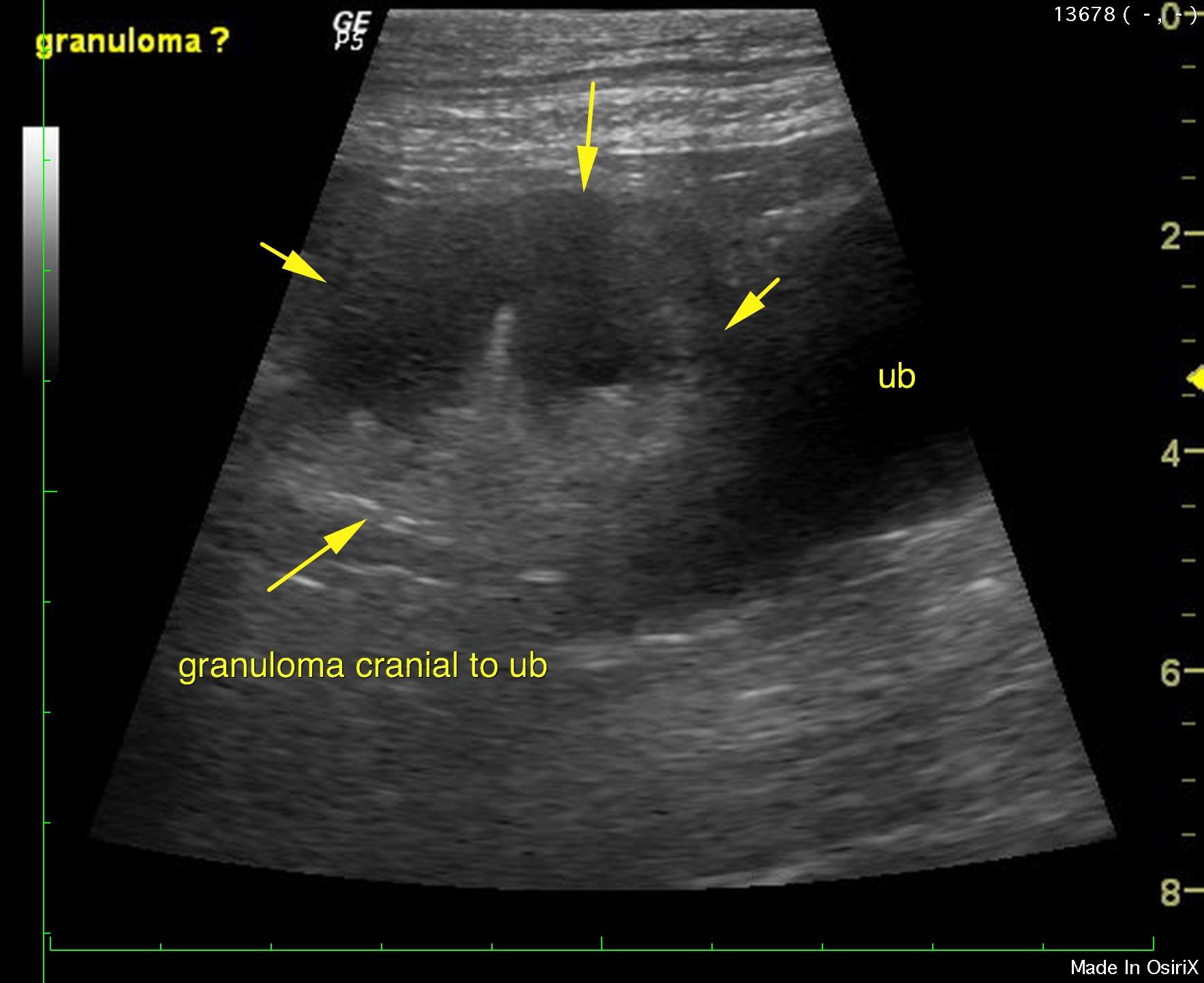 Uterine stump pyometra and CVC vascular anomaly in a 11 year old FS ...
