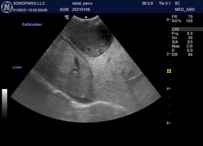 Pancreatic nodule or lymph node - Members