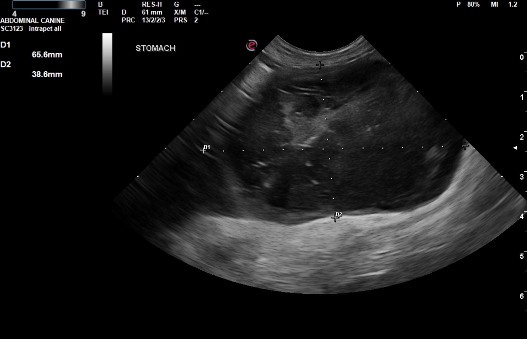 Mural Gastric Abscess with extensive Pancreatitis in a 12 year old FS ...